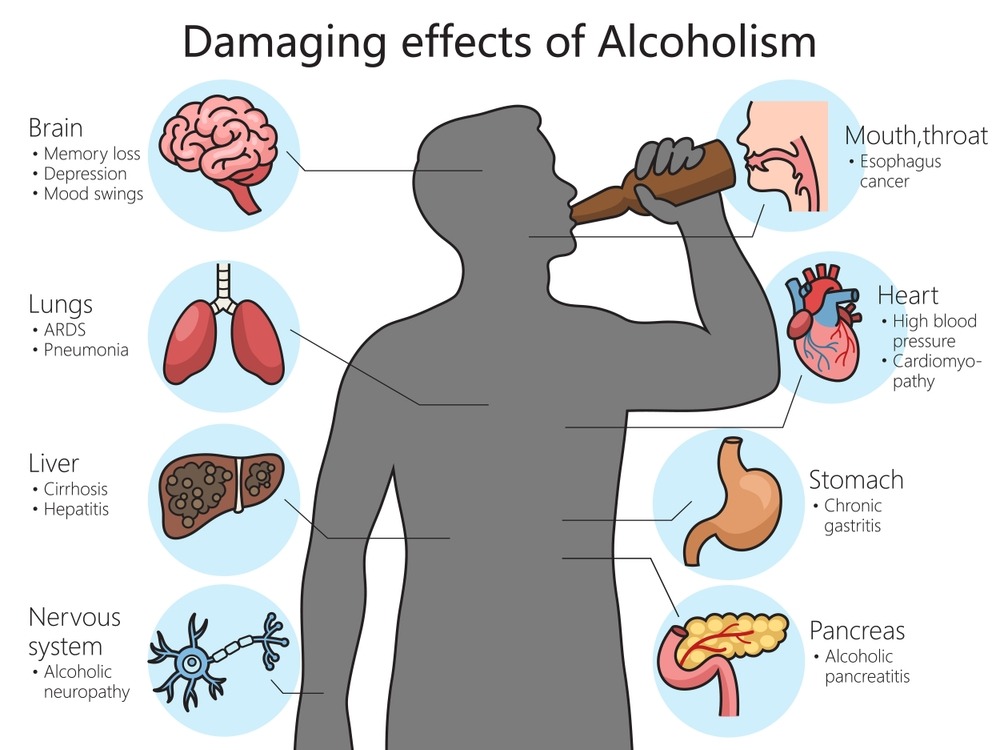 Alcohol Addiction Treatment - Best Rehab Lifeline